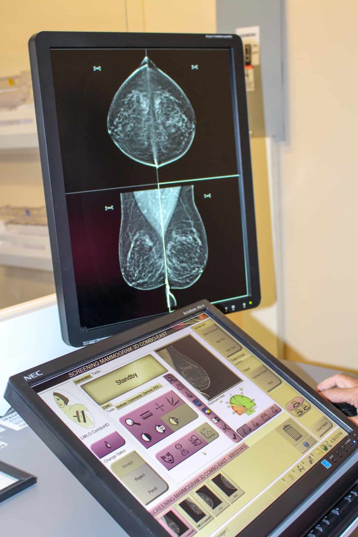 Making mammograms easier: East Campus Imaging Center offers same day ...