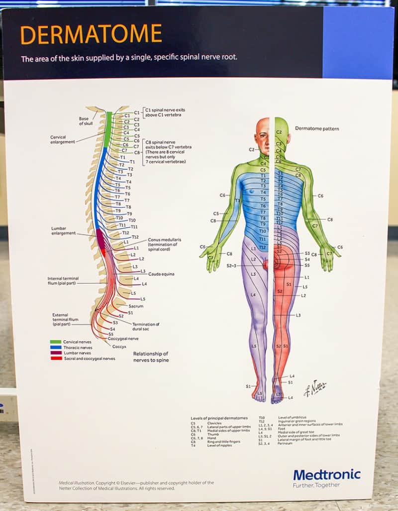 Five things you need to know about Dry Needling at the East Campus ...